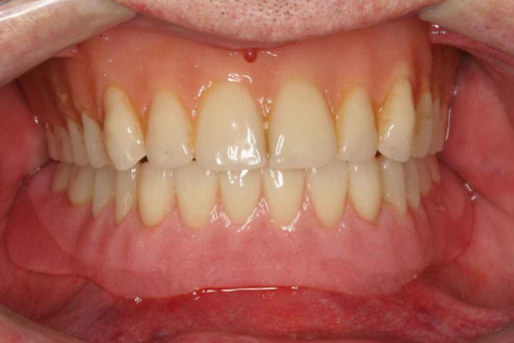 Piedmont Dental Associates serving the Wilkes area